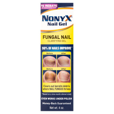 Nonyx Fungal Clarifying Nail Gel, 4 oz - ShopRite